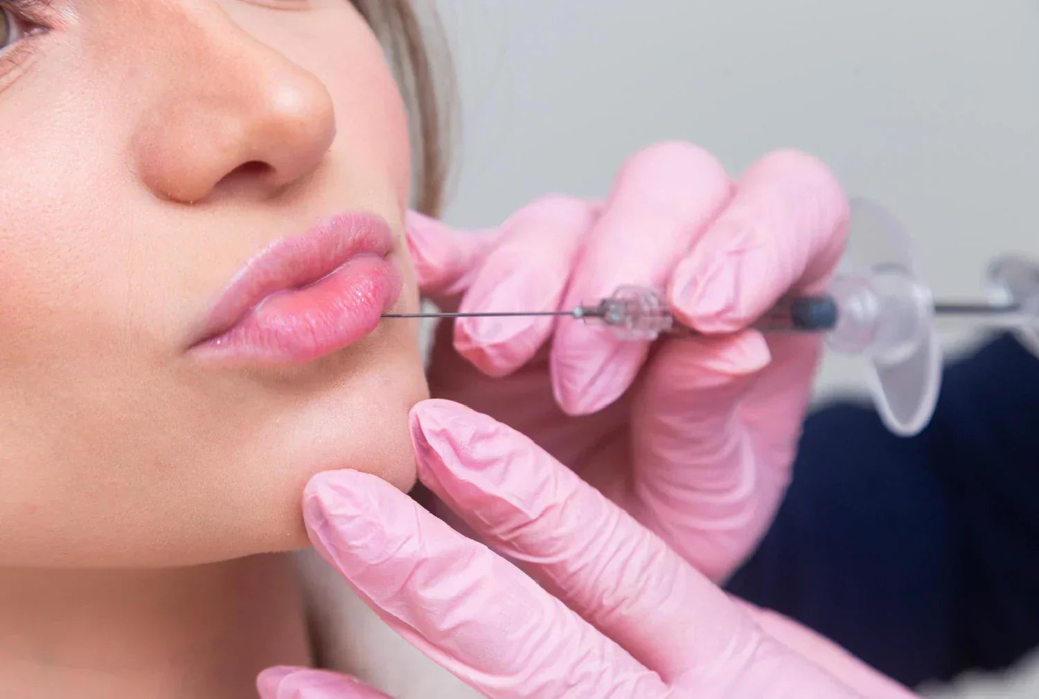 Natural vs Dramatic Lip Injections: Which Look Is Right?