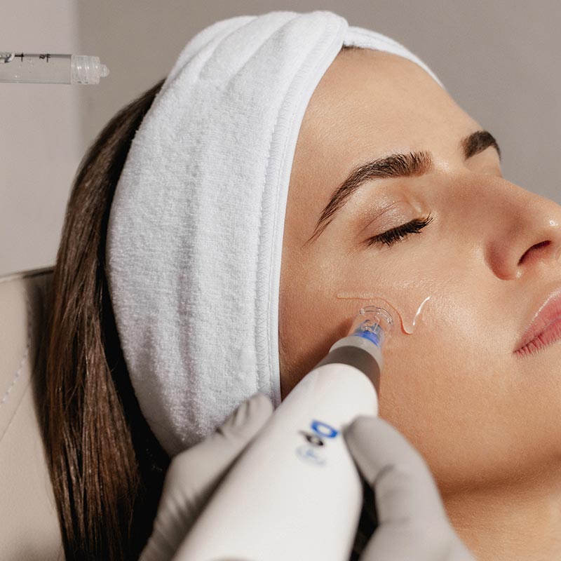 Microneedling by DP4™ Dermapen – AE.R Skinlab